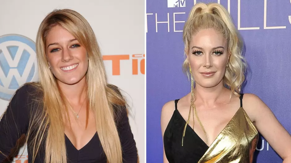 ការផ្លាស់ប្តូររបស់ Heidi Montag ពី 'Laguna Beach' ទៅឥឡូវនេះ: ការវះកាត់កែសម្ផស្ស អាពាហ៍ពិពាហ៍ ភាពជាម្តាយ