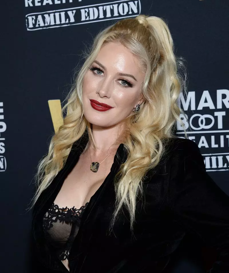 Heidi Montag ප්ලාස්ටික් සැත්කම් පරිවර්තනය 2019