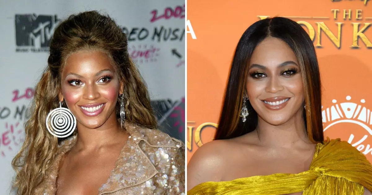 Huet d'Beyoncé Plastesch Chirurgie kritt? Singer's Transformation Photos