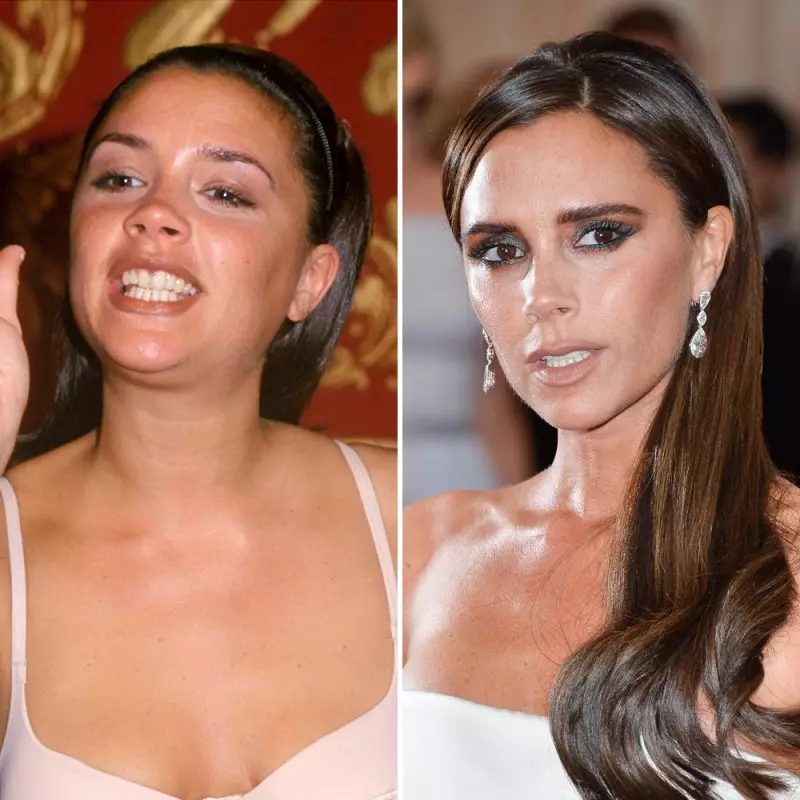 Victoria beckham csúnya