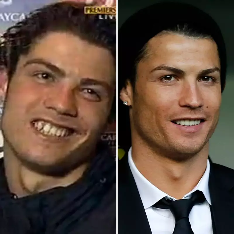 Cristiano Ronaldo xunuk