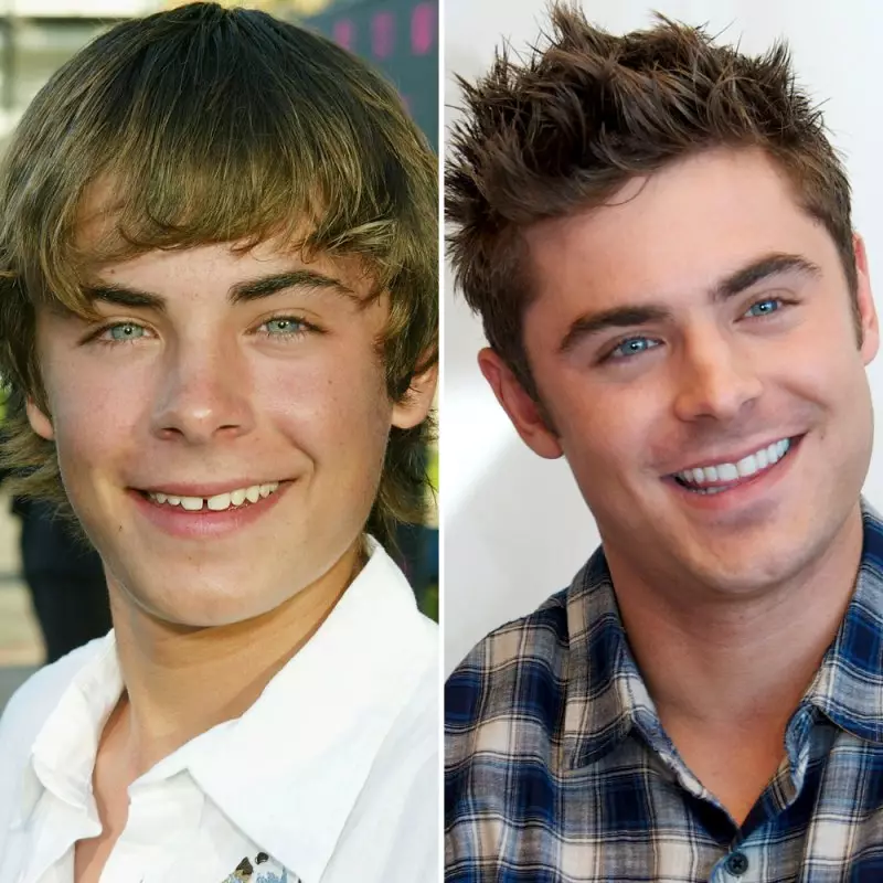 Zac efron brzydki