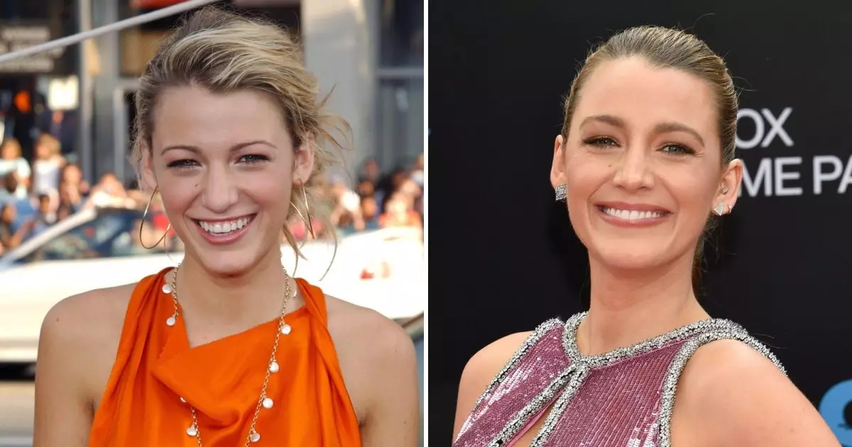 Blake'o Lively transformacija iš jaunystės į dabar: nuotraukos