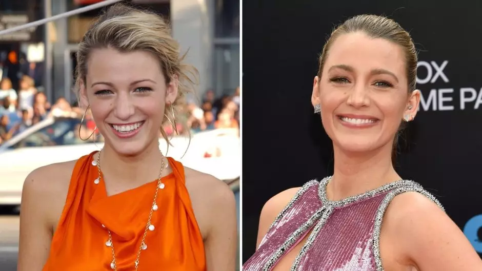 Mga Litrato sa Blake Lively Transformation