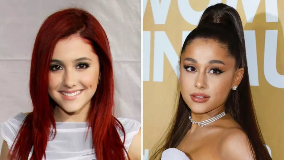 Ariana Grande a-t-elle subi une chirurgie plastique ? Sa métamorphose