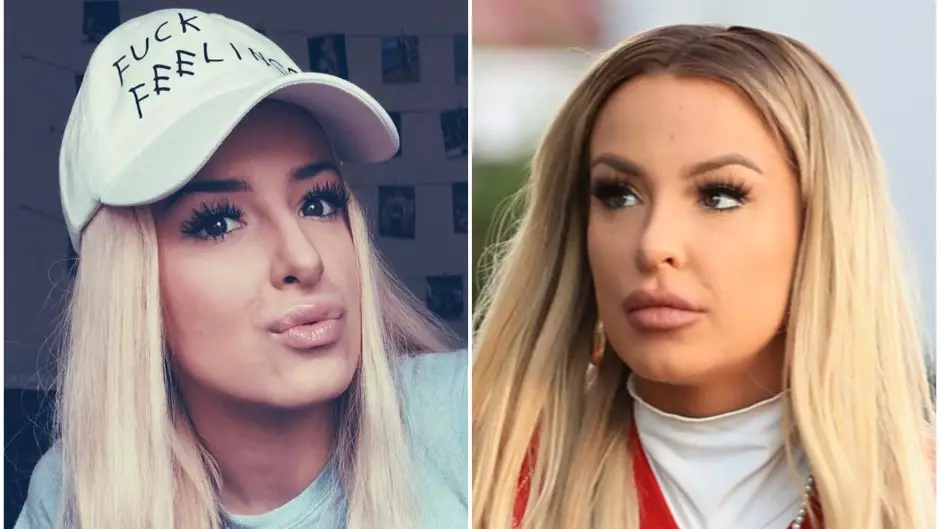 Tana mongeau plastična kirurgija