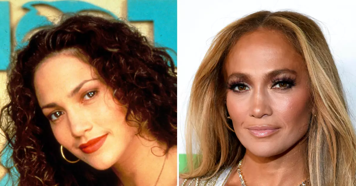 Jennifer Lopez nwere ịwa ahụ plastik? Foto mgbanwe