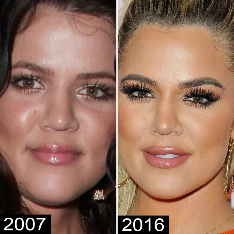 Khloe kardashian ពេញមុខ