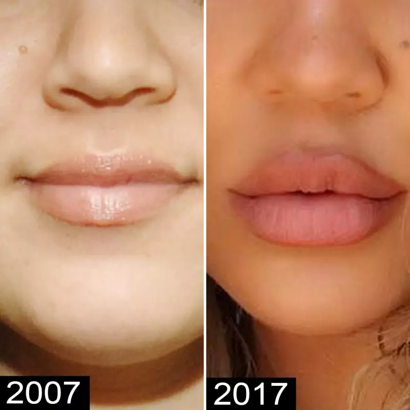 Khloe Kardashian-Lippen
