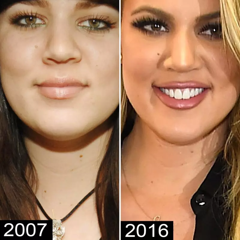 Khloe kardashian eňegi 2