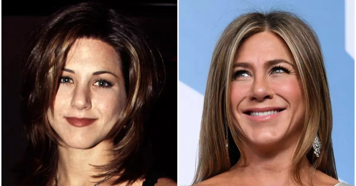 Jennifer Aniston plasztikai műtéten esett át? Megjegyzések, eljárások, egyebek