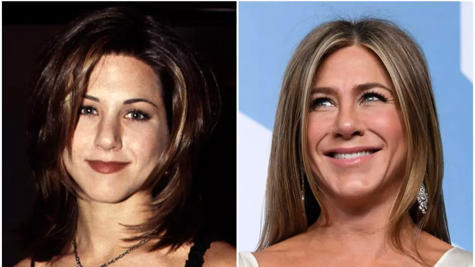 jennifer-aniston-plastyske sjirurgy