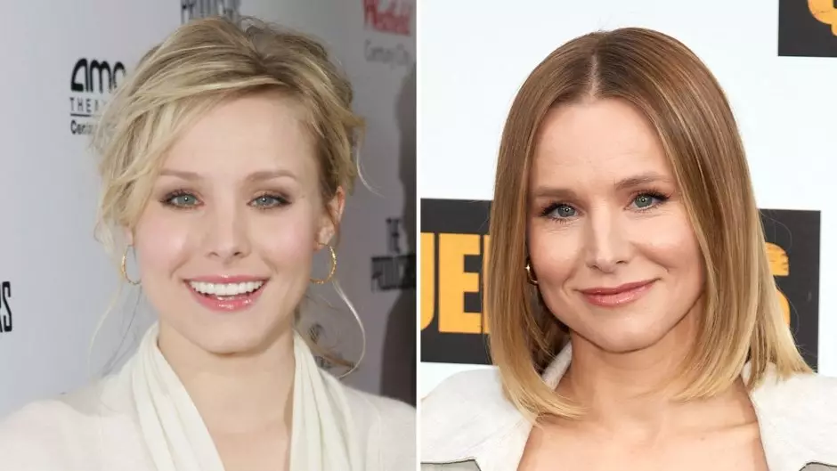 Saiko Kristen Bell plastiikkaleikkauksen? Hänen transformaatiokuvansa 1791_1