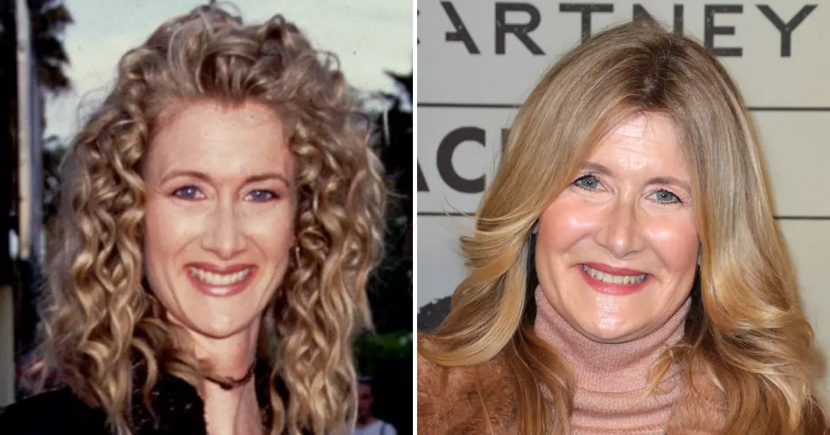 A gafodd Laura Dern Lawdriniaeth Blastig? Trawsnewid yr Actores