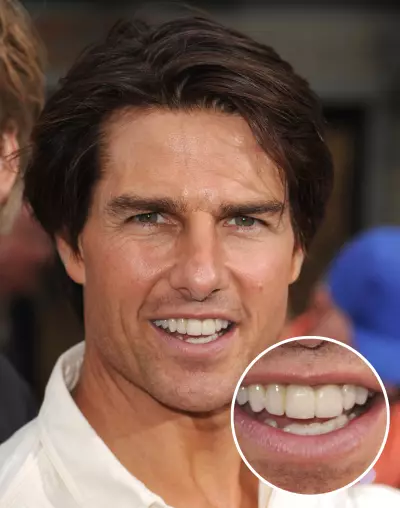 tom cruise mellemtand