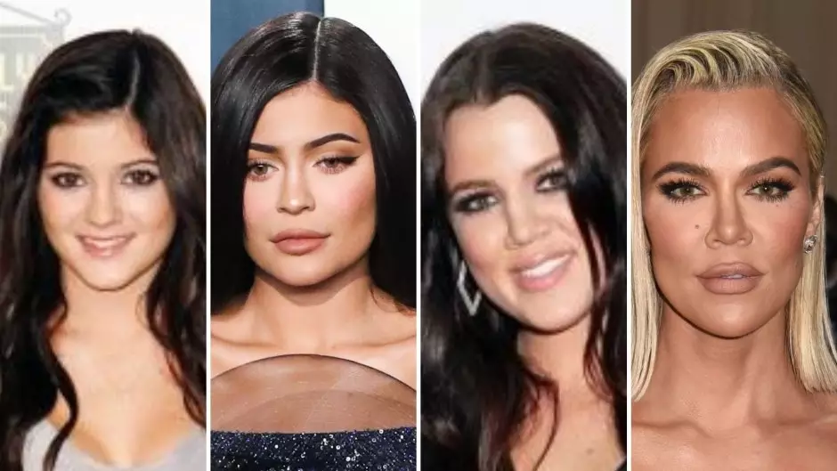 Plastinė operacija? Kardashian-Jenner šeimos transformacijos bėgant metams