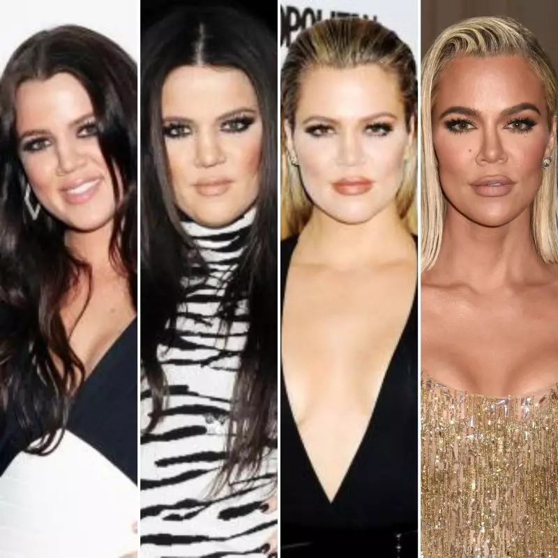 Plastinė operacija? Kardashian-Jenner šeimos transformacijos bėgant metams