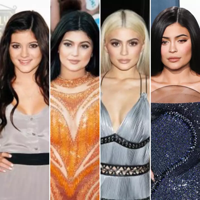Kylie-Jenner-plastinė-chirurgija-transformacija