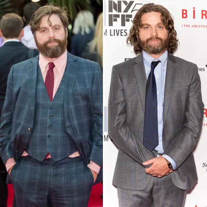 Zak Galifianakis vazn yo'qotish 29