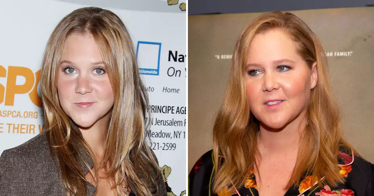 Naha Amy Schumer Kéngingkeun Bedah Plastik? Poto Transformasi