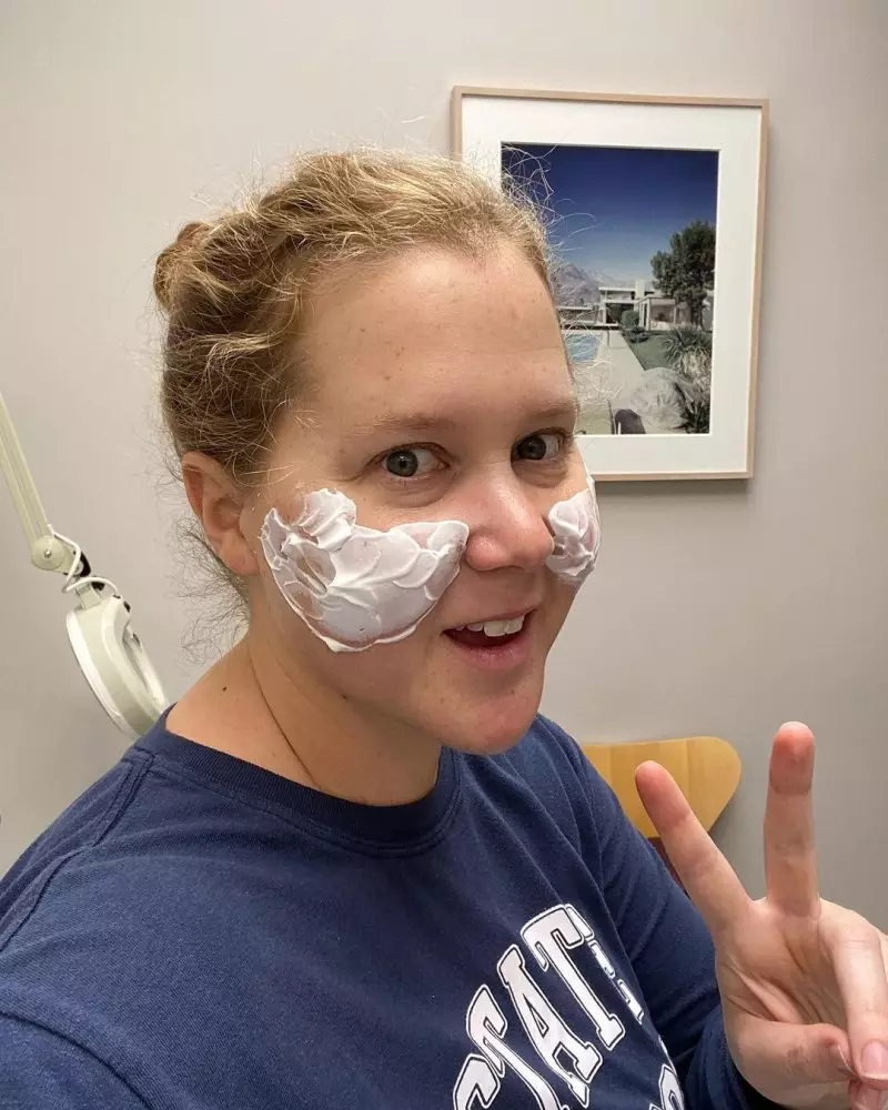 Amy Schumer ละลายฟิลเลอร์หลังทำศัลยกรรม: 'ฉันดูเหมือนคนร้าย'