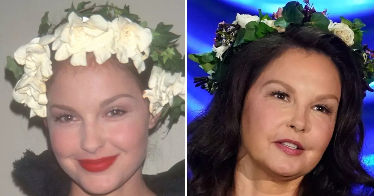 Ashley Judd nwetara ịwa ahụ plastik? Foto mgbanwe