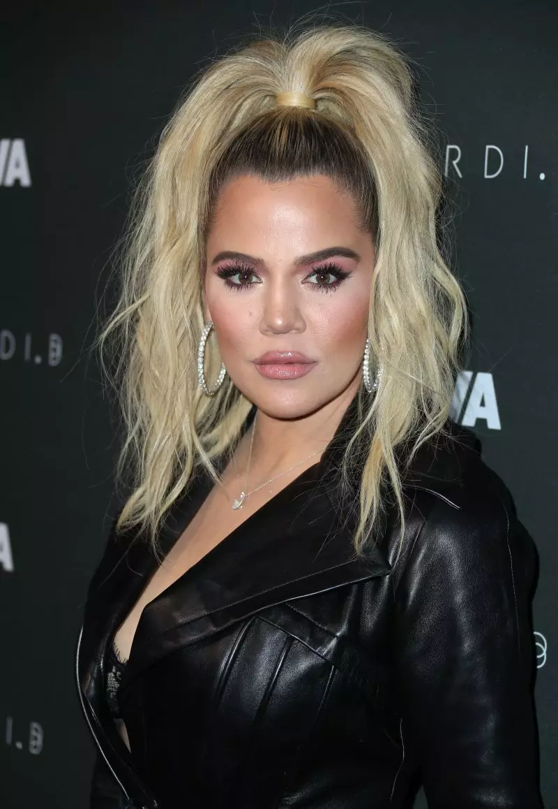 Khloe Kardashian plastinė chirurgija