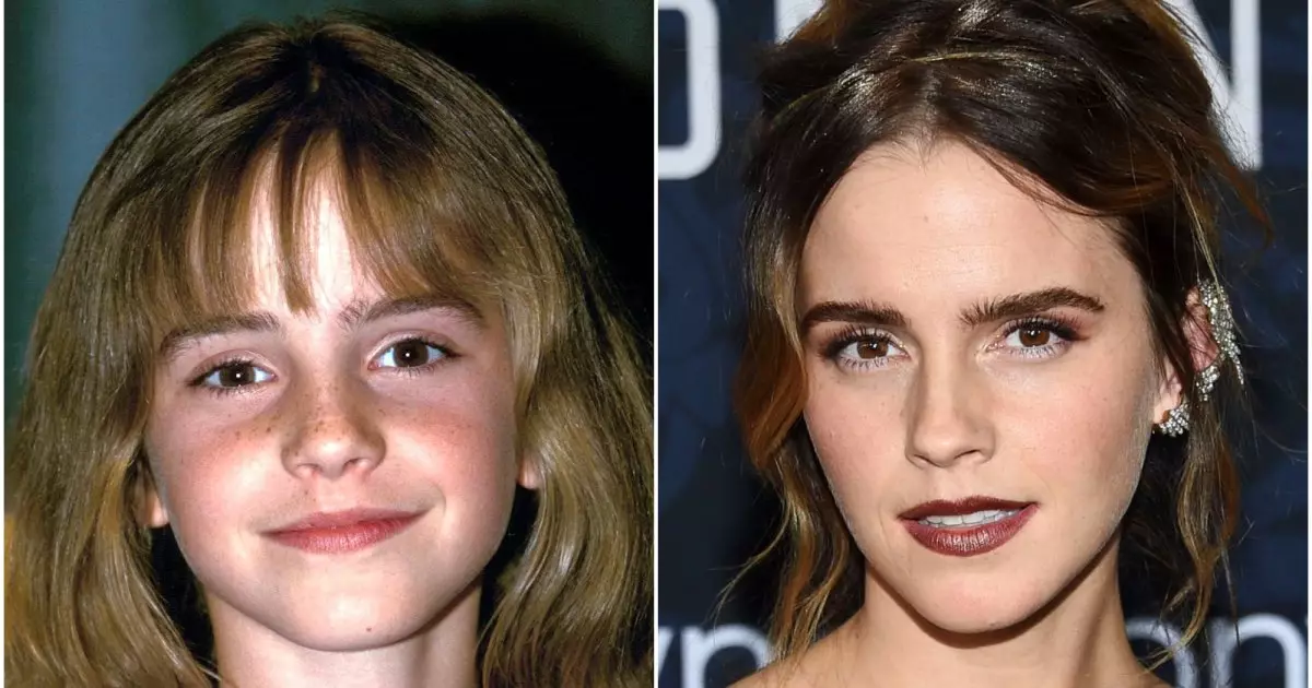 Transformation d'Emma Watson : de "Harry Potter" à aujourd'hui