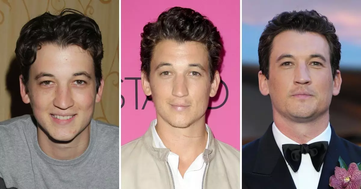 Miles Teller-en eraldaketa urteetan zehar: Argazkiak Lehen eta Orain