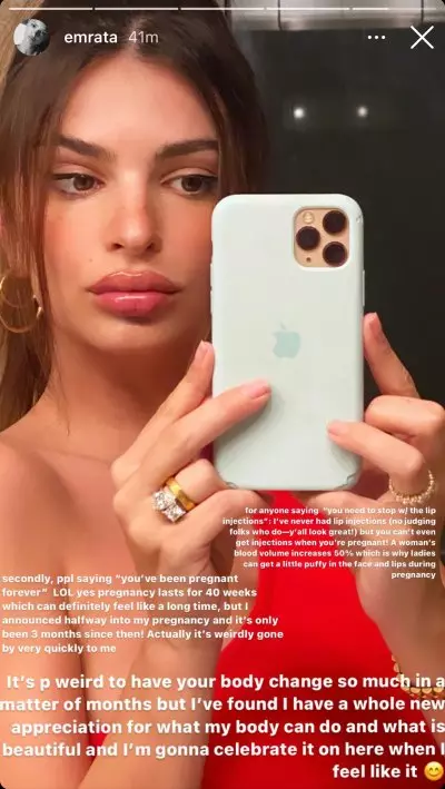 embarazada-emily-ratajkowski-slams-lip-injection-claims-ig