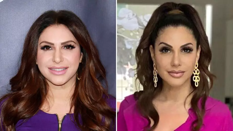 Jennifer Aydin Plastic Surgery