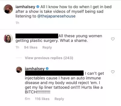 Halsey o re ha a khone ho fumana li-filler ka lebaka la lefu la autoimmune