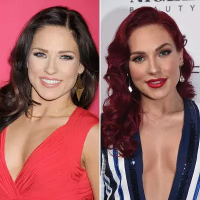 'Dancing With the Stars'-professionelle, der har talt om plastikkirurgi Sharna Burgess