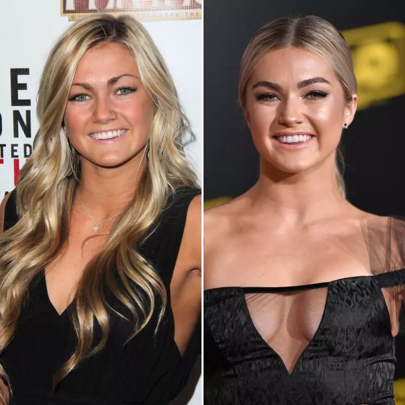 'Dancing With the Stars'-professionelle, der har talt om plastikkirurgi Lindsay Arnold