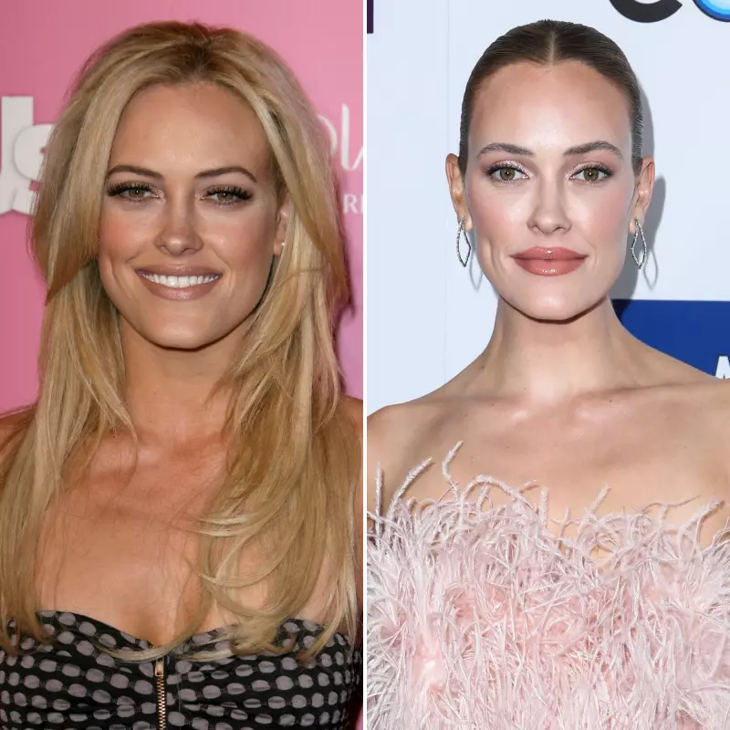 'Dancing With the Stars'-professionelle, der har talt om plastikkirurgi Peta Murgatroyd