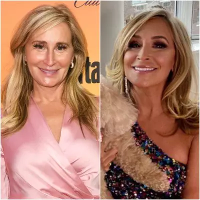 Sonja Morgan Kubaga Plastike Mbere na Nyuma Ifoto