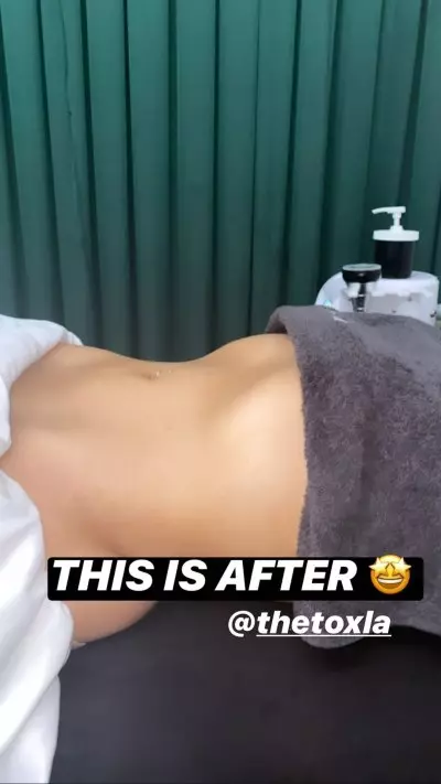 jordyn-osisi-lymphatic-drainage-ịhịa aka-ig