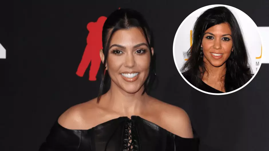 Kourtney Kardashian ප්ලාස්ටික් සැත්කම් කළාද? ඡායාරූප, උපුටා දැක්වීම්