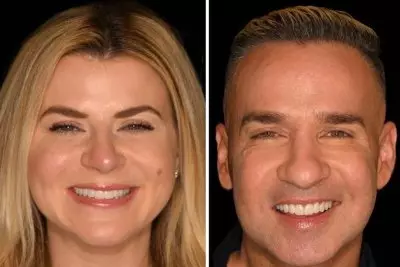 Mike The Situation Sorrentino Esposa Lauren faz uma reforma dentária para casais ver novos folheados de 50 mil