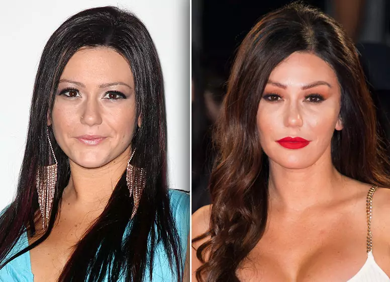 LS: GTL! Gweler y 'Jersey Shore' Stars ' Trawsnewidiadau Llawfeddygaeth Blastig Dros y Blynyddoedd