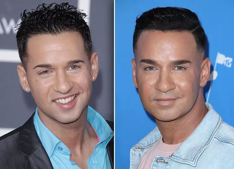 LS: GTL! Kuckt d''Jersey Shore' Stars' Plastesch Chirurgie Transformatiounen iwwer d'Joren