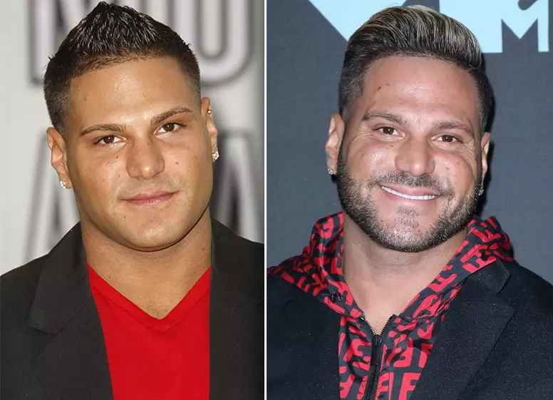 LS: GTL! Kuckt d''Jersey Shore' Stars' Plastesch Chirurgie Transformatiounen iwwer d'Joren