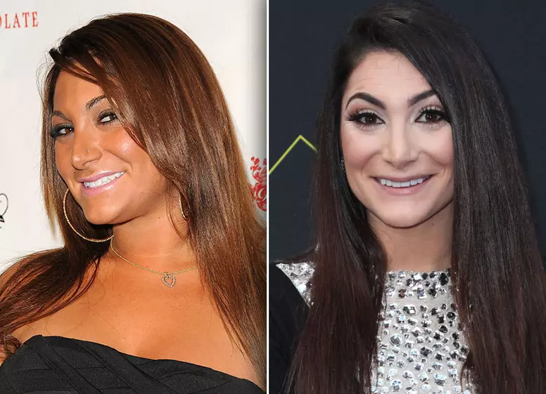 LS: GTL! Gweler y 'Jersey Shore' Stars ' Trawsnewidiadau Llawfeddygaeth Blastig Dros y Blynyddoedd