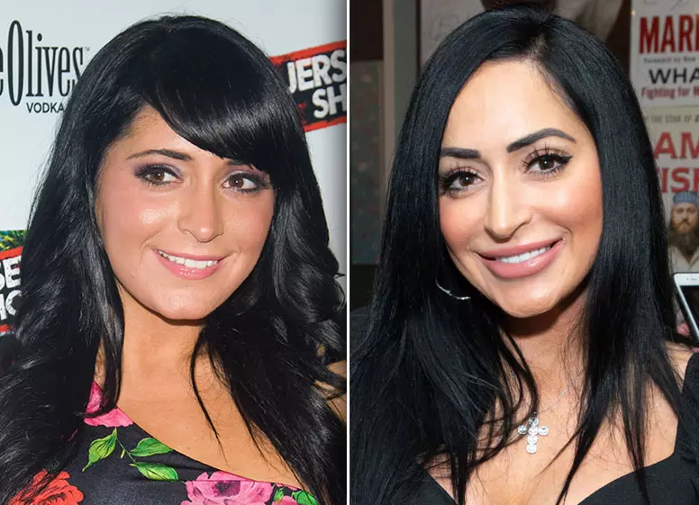 LS: GTL! Kuckt d''Jersey Shore' Stars' Plastesch Chirurgie Transformatiounen iwwer d'Joren