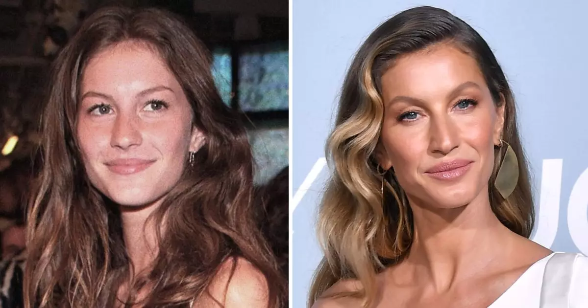 Gisele Bundçeniň plastiki hirurgiýasy boldumy? Üýtgetme suratlary