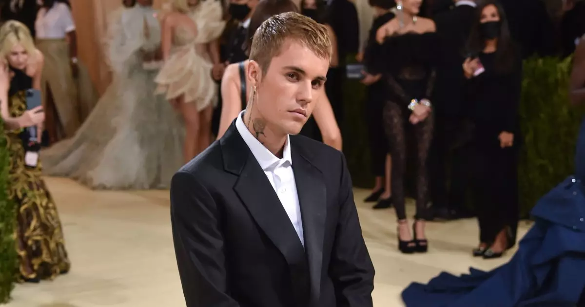 La sindrome medica di Justin Bieber gli paralizza il viso: guarda il video