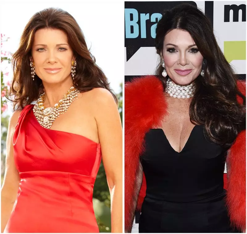 Lisa vanderpump 过去和现在