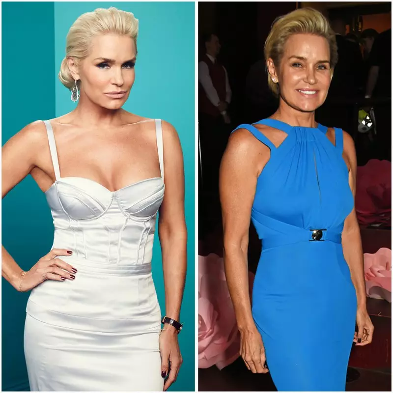 Yolanda hadid එදත් අදත්