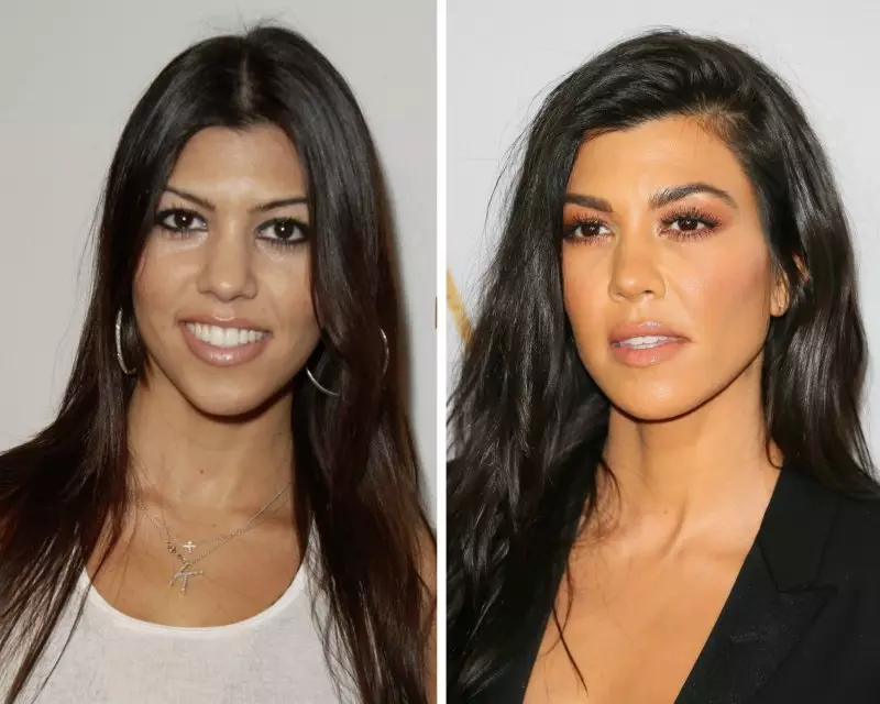 Kourtney Kardashian prije i poslije plastične operacije