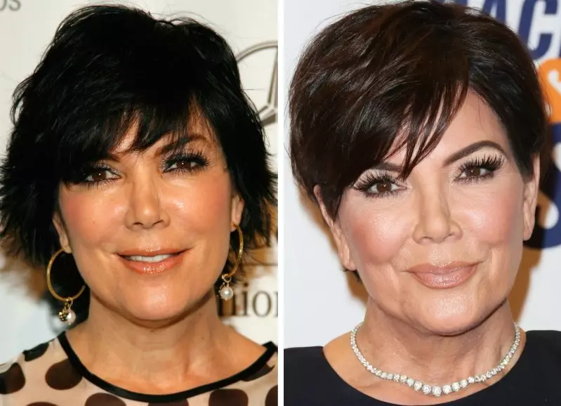 Kris jenner ກ່ອນແລະຫຼັງການຜ່າຕັດສຕິກ